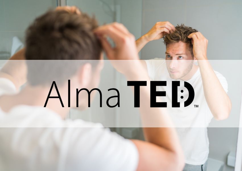 Alma TED Hair Restoration - Northshore Rejuvenation
